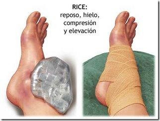 C.A. CORRELIANA: LESIONES - METODO RICE
